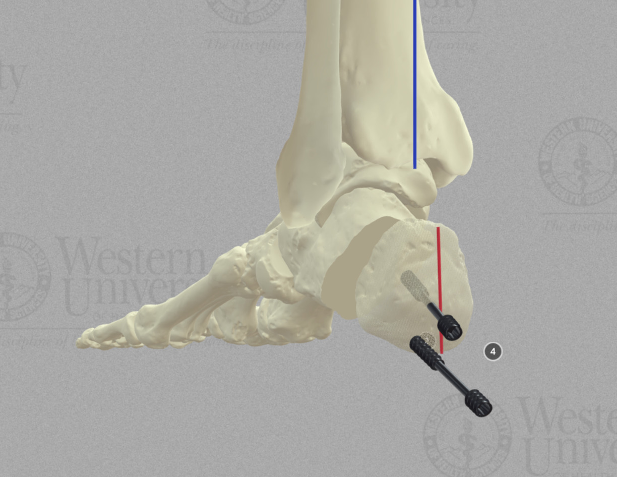 WesternU CPM and CETL develop 3D animations depicting lower extremity ...